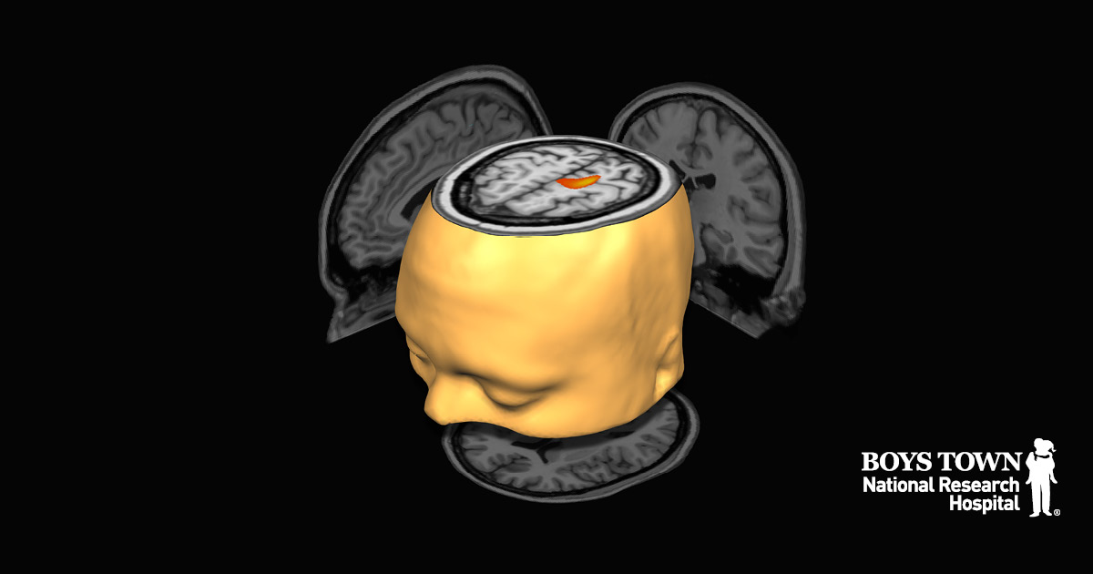 Physical Therapy May Hold the Key to Brain-Based Changes in Adults with ...